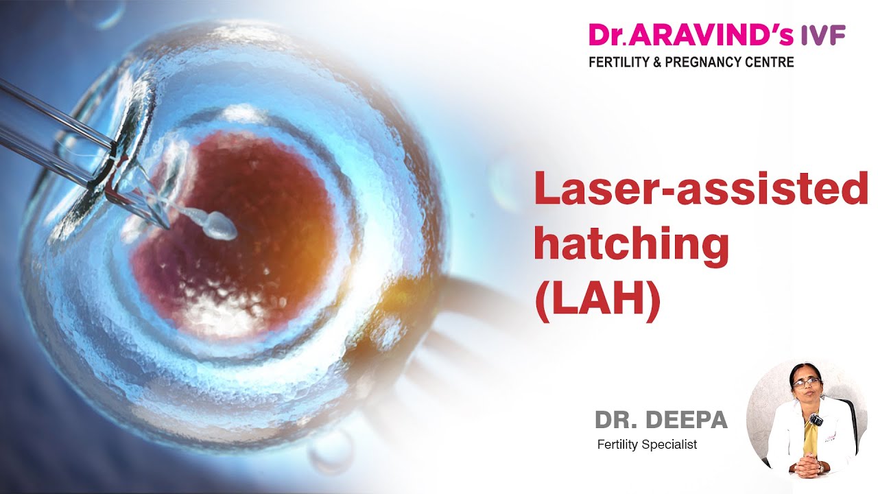 Laser - Assisted Hatching (LAH) | Best IVF Fertility Centre | Dr ...