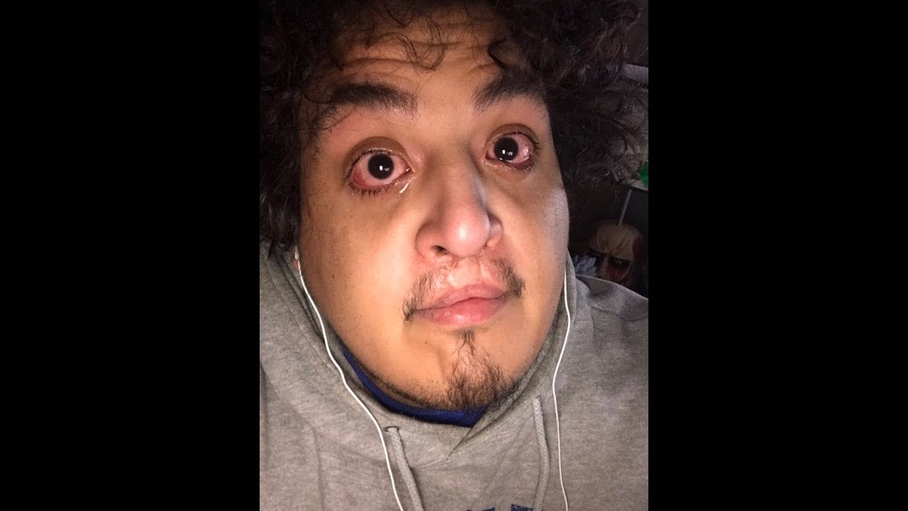 Crazy Anime Fan Wants To Fight ForneverWorld Vs YonkouProductions crazy-anime-fan-wants-to-fight-forneverworld-vs-yonkouproductions
