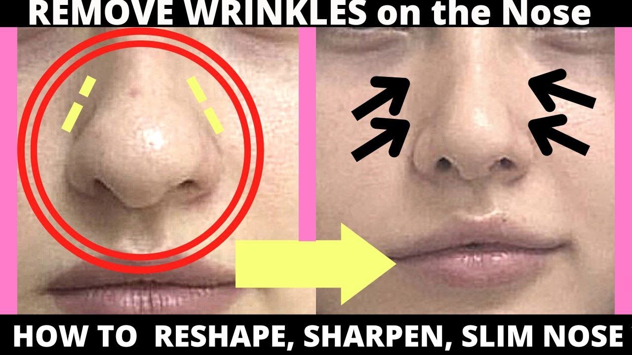 How to Reshape, Sharpen and Slim down Nose | No surgery | Remove ...