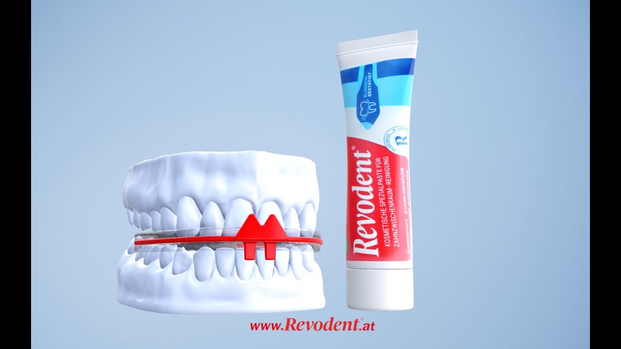 Revodent - 3D Animation - YouTube