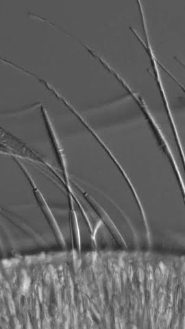 Microscopia de cnidócitos - YouTube