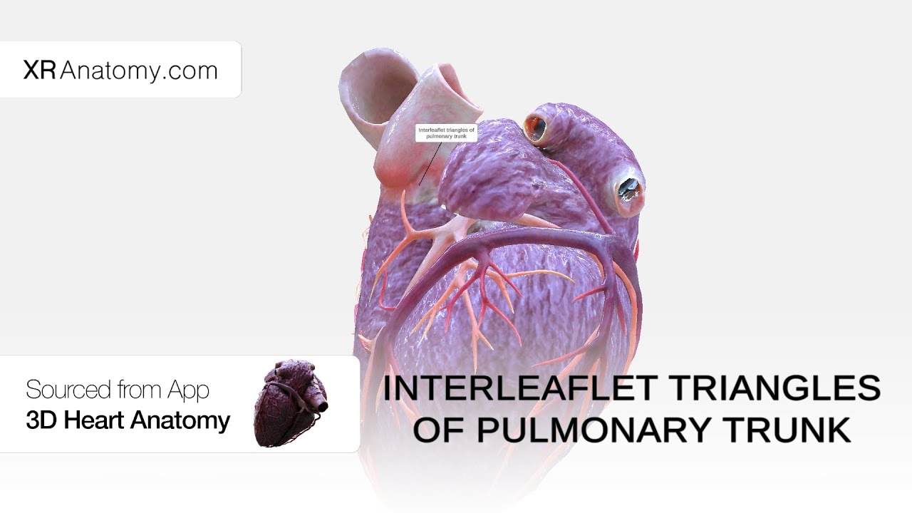 Interleaflet triangles of pulmonary trunk - YouTube