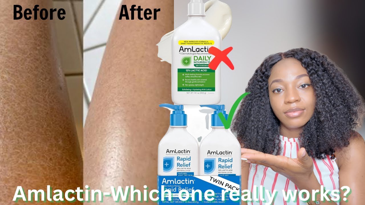 Amlactin: The Best Lotion for a clear and radiant Skin? - YouTube