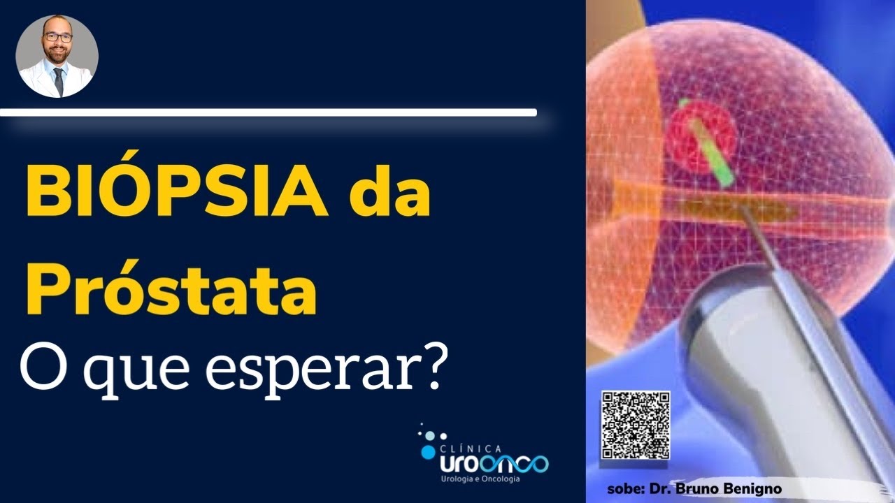 O que esperar de sua biópsia de próstata?