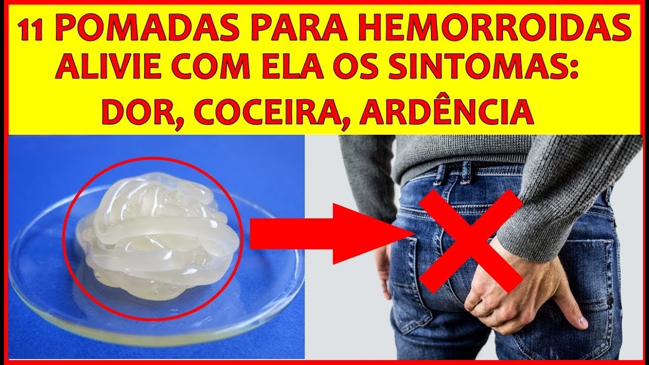 11 Pomadas para Hemorroidas Externas Inflamadas e Internas Alívio nos ...