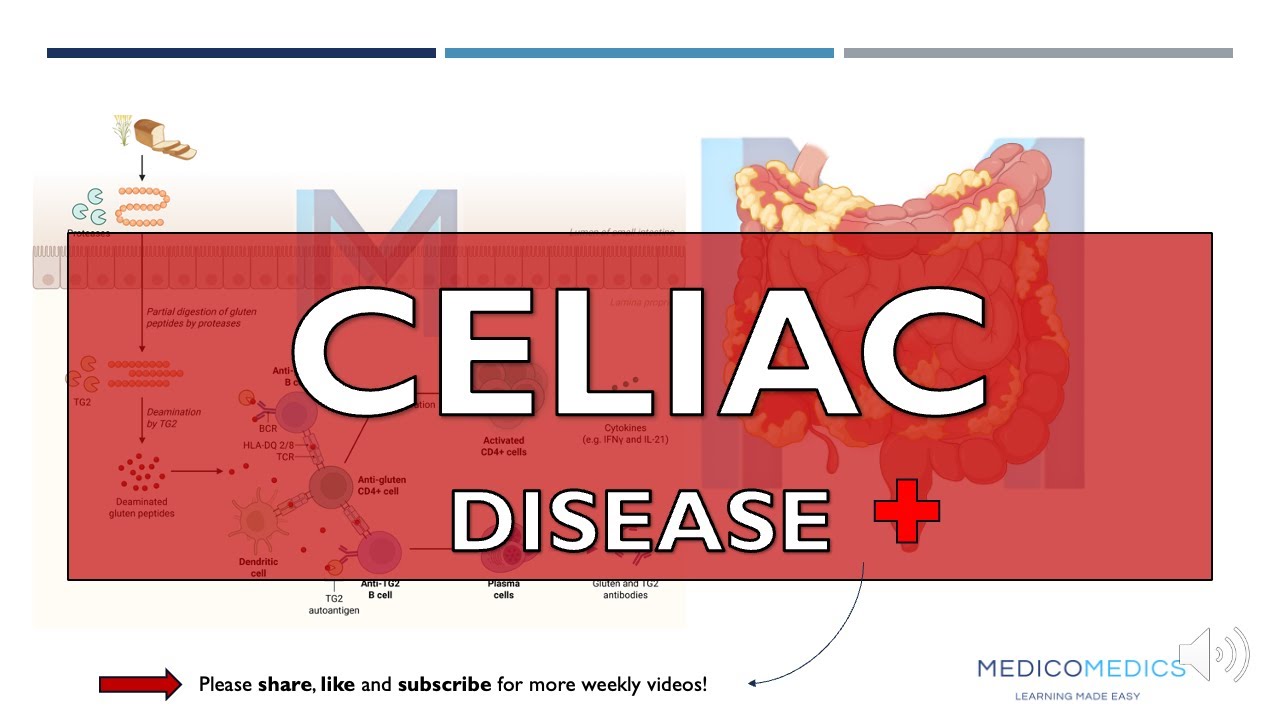 Celiac Disease | Symptoms, Pathophysiology, Diagnosis & Treatment - YouTube