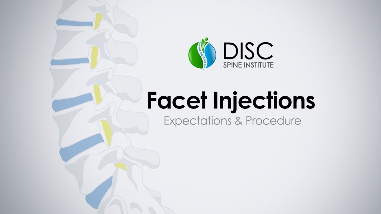 Facet Injections: Expectations & Procedure - YouTube