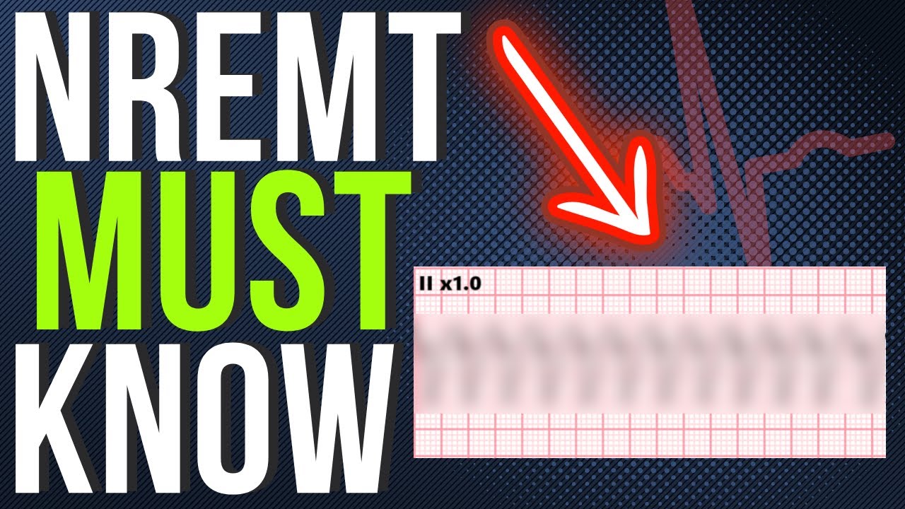 NREMT Tachycardia Review - Must Know For Static And Dynamic Cardiology ...