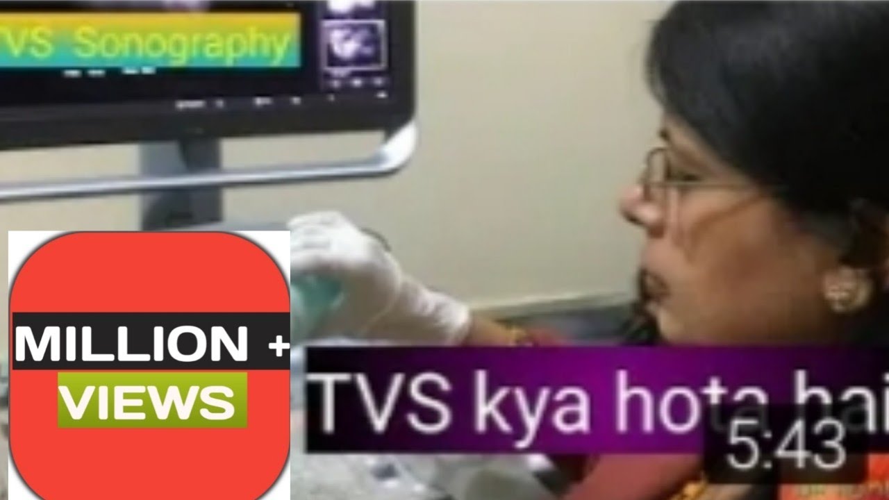 Transvaginal ultrasound/टीवीएस सोनोग्राफी क्या है/Doctor home /TVS ...