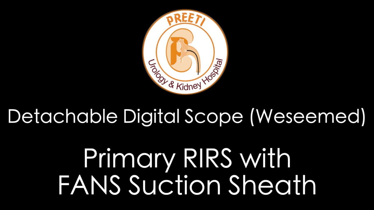 Detachable Digital Scope (Weseemed) : Primary RIRS with FANS Suction ...