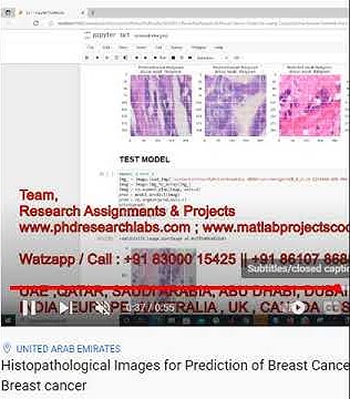 Histopathological Images for Prediction of Breast Cancer Using python ...