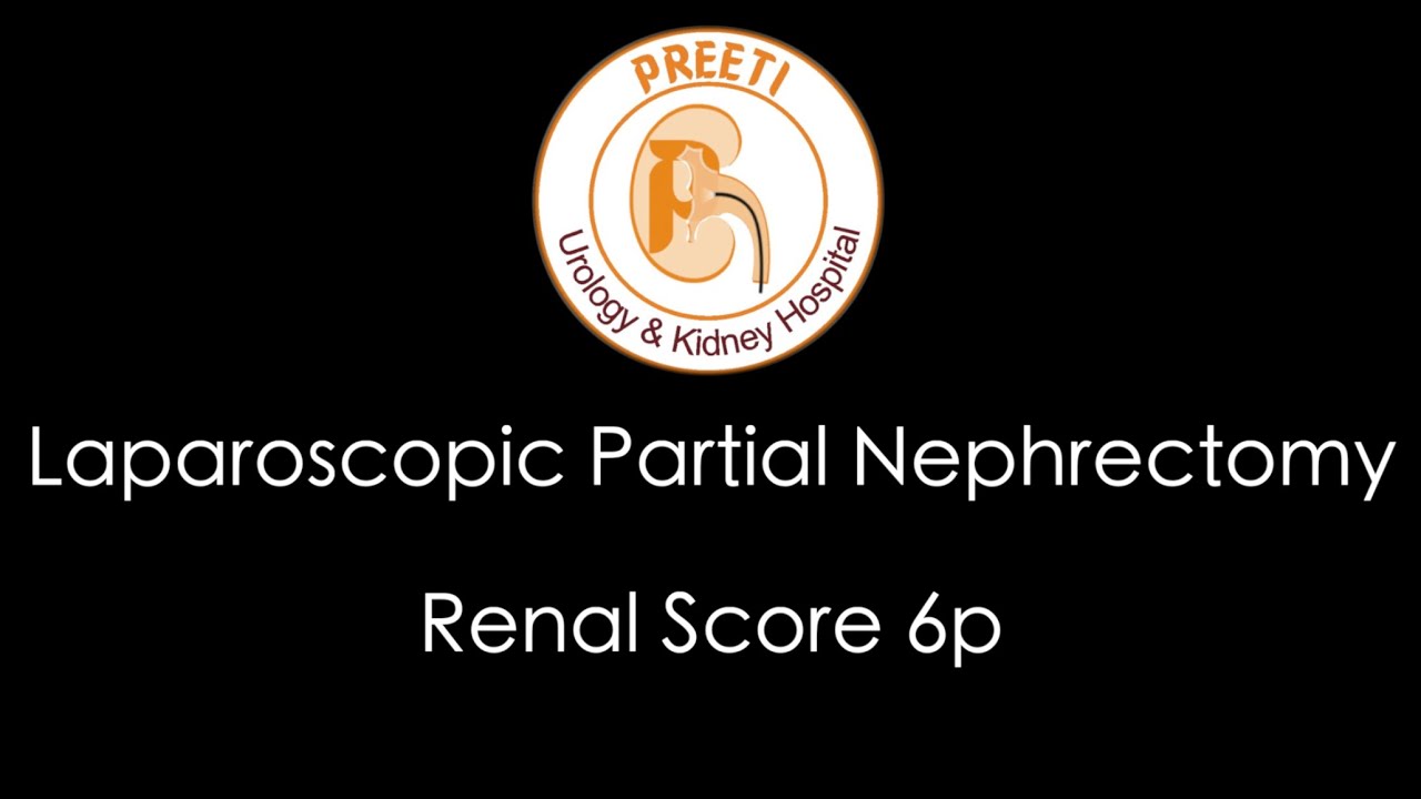 Laparoscopic Partial Nephrectomy - Renal Score 6p (Unedited) English ...