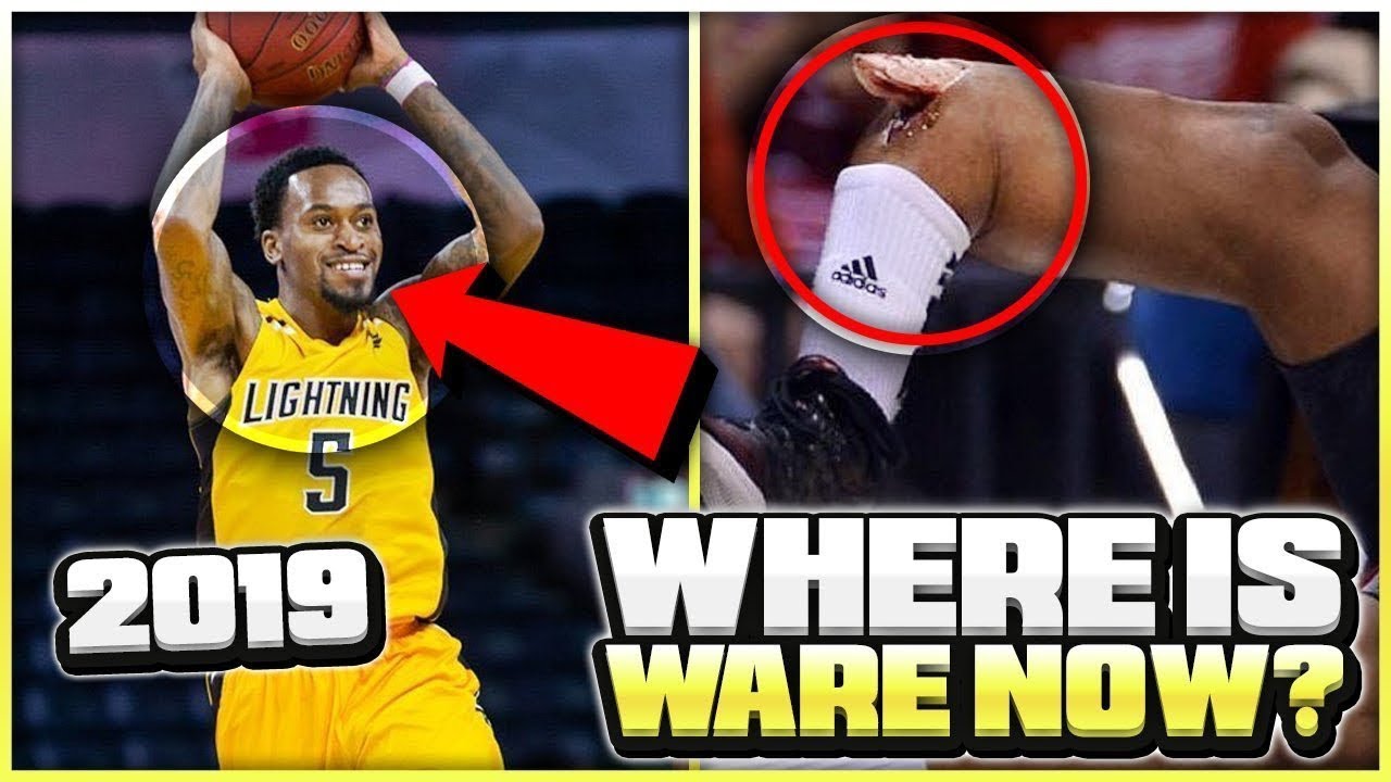 NBA Stories EP15 - Where Is KEVIN WARE Now In 2019! WORST injury in ...
