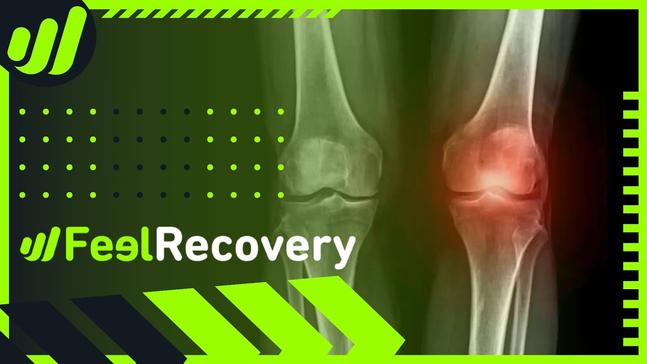 🟢 LUXACIÓN DE RODILLA - Tipos, Causas, Síntomas y Tratamiento - YouTube