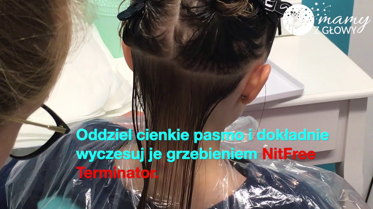 ZWALCZANIE WSZAWICY W PRAKTYCE - jak skutecznie usunąć wszy i gnidy ...