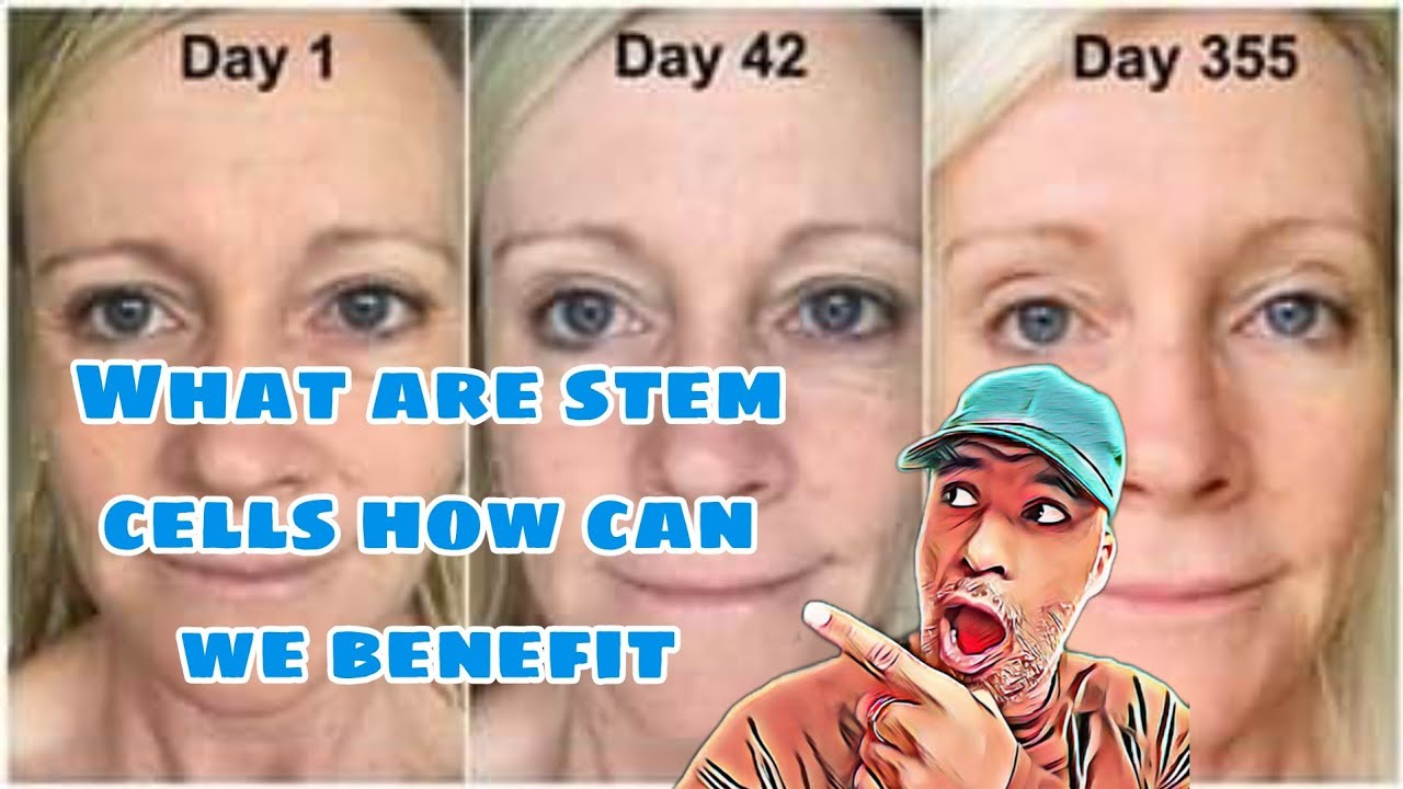 What Are Stem Cells How Can We Benefit YouTube what-are-stem-cells-how-can-we-benefit-youtube