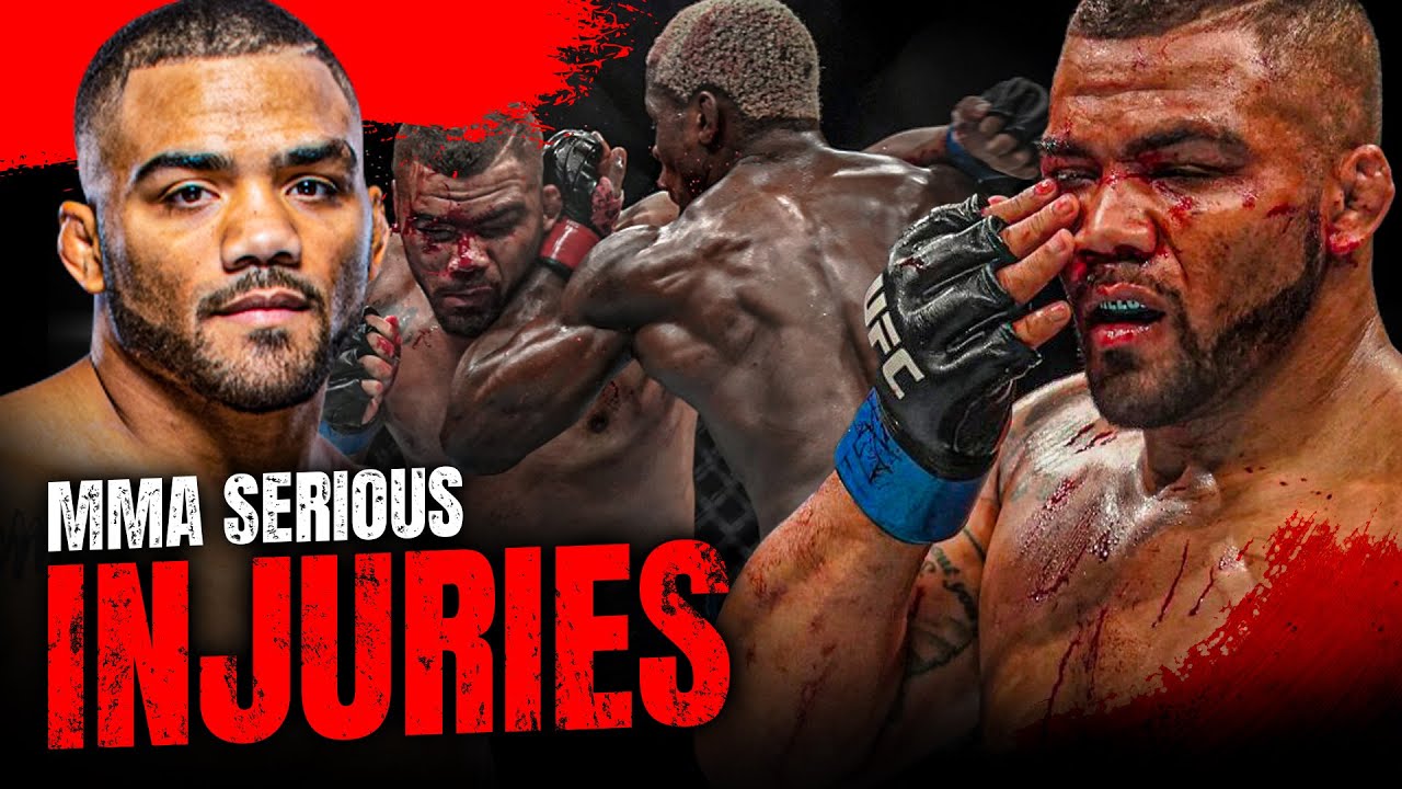 Top 10 MMA injuries in UFC - YouTube