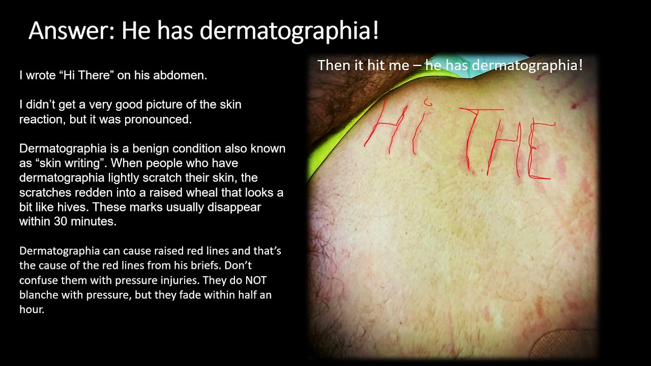 Red Lines Appear On Skin