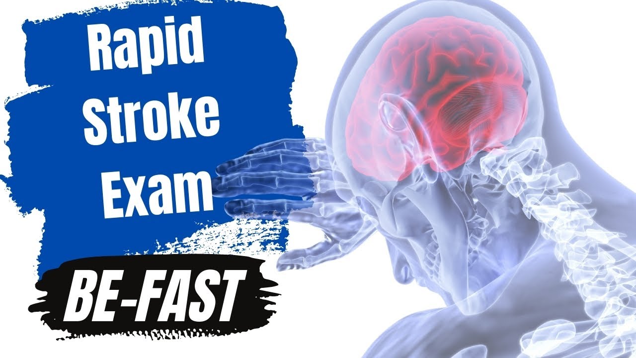 BE FAST Stroke Assessment | Signs of Stroke | "Something In About 5 ...