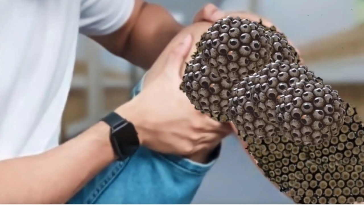 ASMR Animation Treatment | ASMR Collection Animation Video|@BrekASMR ...