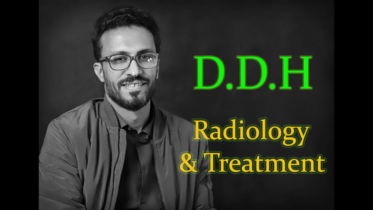 03 D.D.H: Radiology & Treatment - YouTube