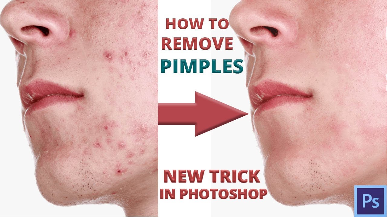 How To Remove Pimples In Photoshop Cc Or Cs6 2021 new Trick YouTube how-to-remove-pimples-in-photoshop-cc-or-cs6-2021-new-trick-youtube
