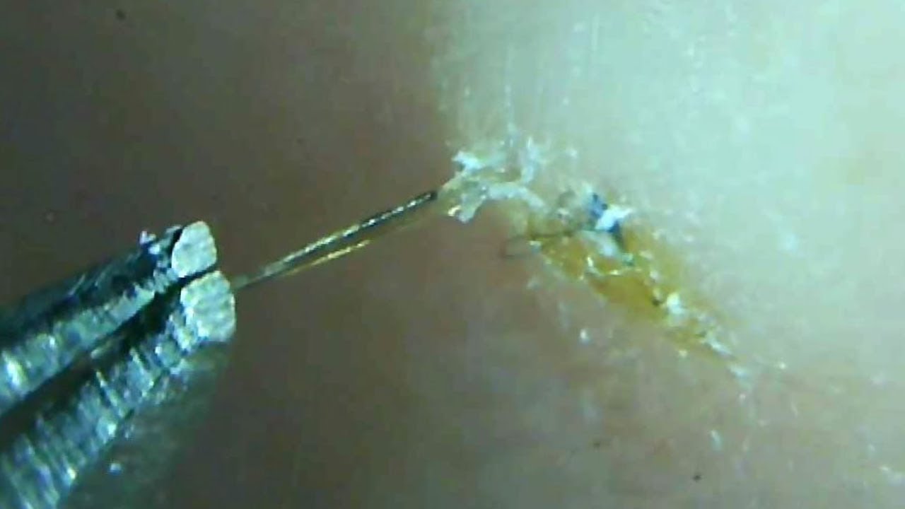 Get a Load of This Plucking! - YouTube