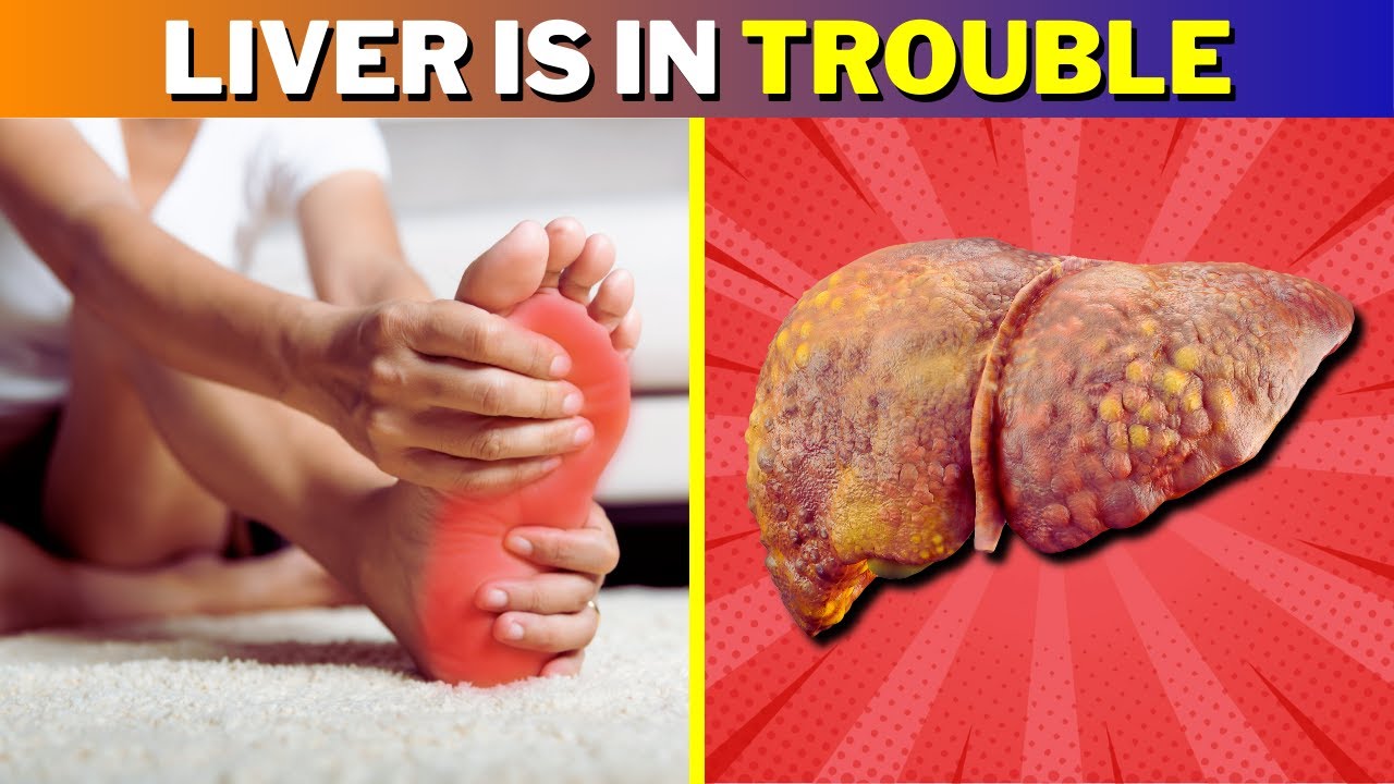 7 Signs Your Feet Are Telling You That Your Liver Is In Trouble - YouTube