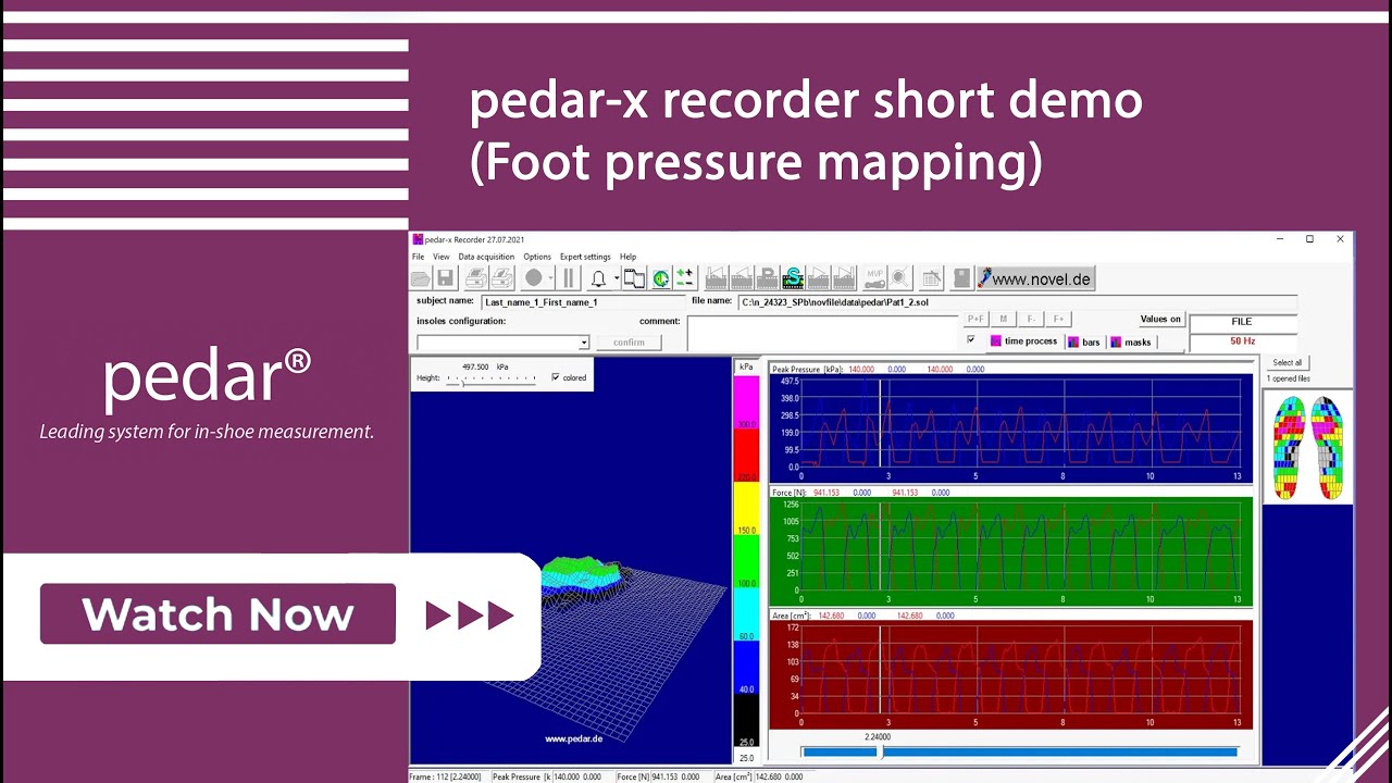 pedar-x recorder short demo (Foot pressure mapping) - YouTube