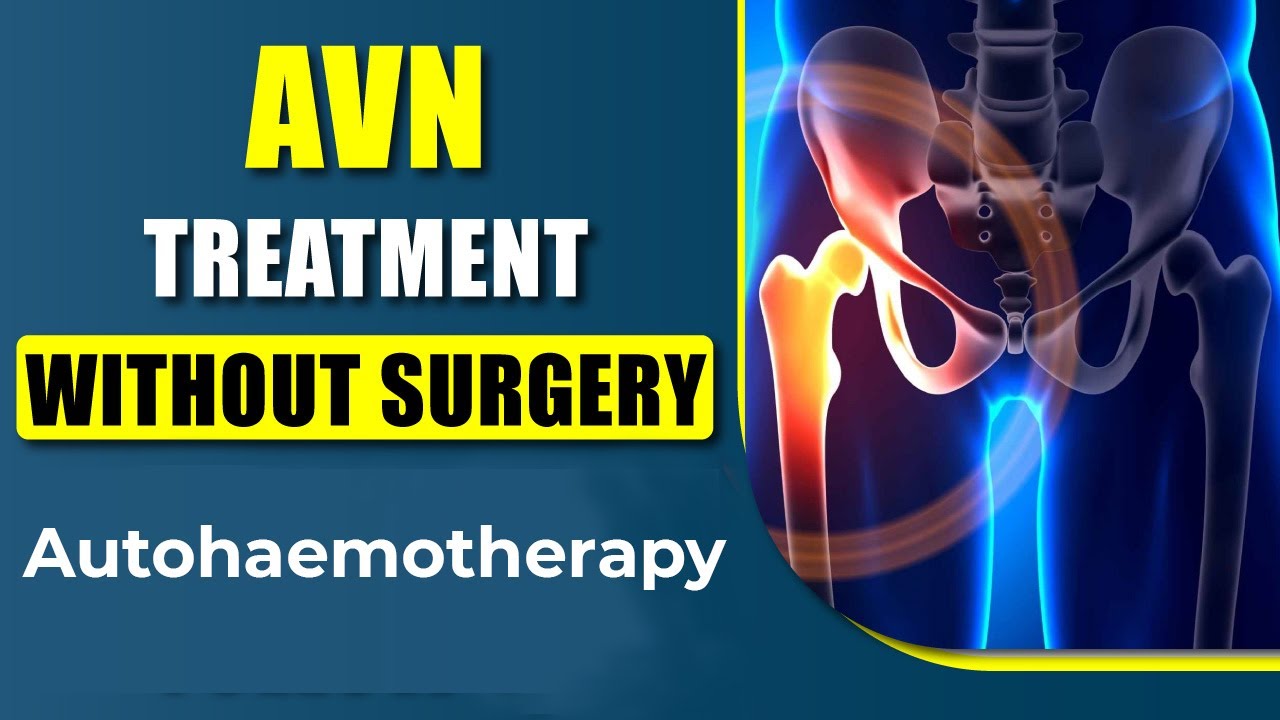 AVN Treatment Without Surgery Review After 1 Year by Dr. Sunil Saini # ...