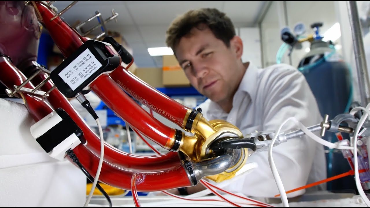 Man lives 100 days with artificial titanium heart in world-first ...