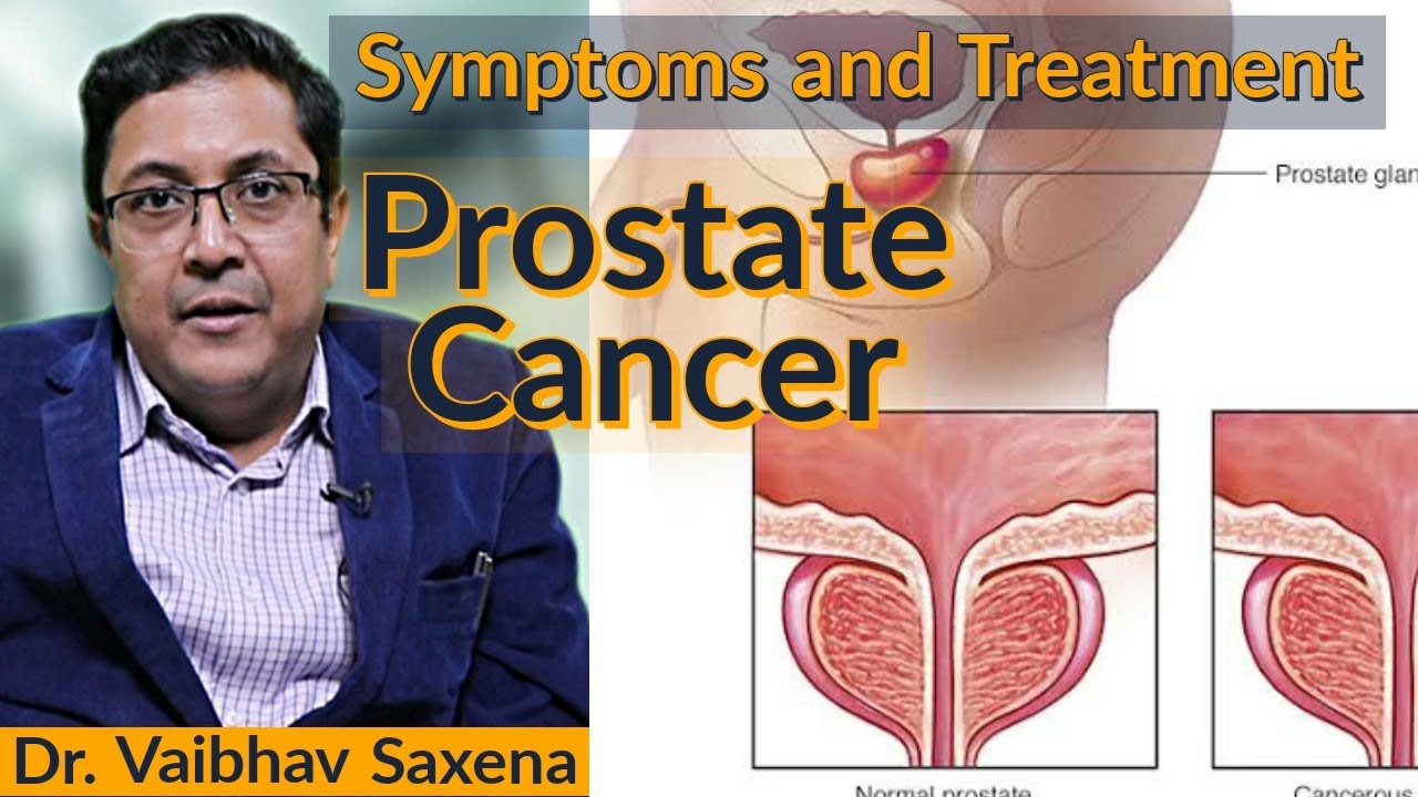 Prostate Cancer Symptoms Early Detection And Treatment YouTube prostate-cancer-symptoms-early-detection-and-treatment-youtube