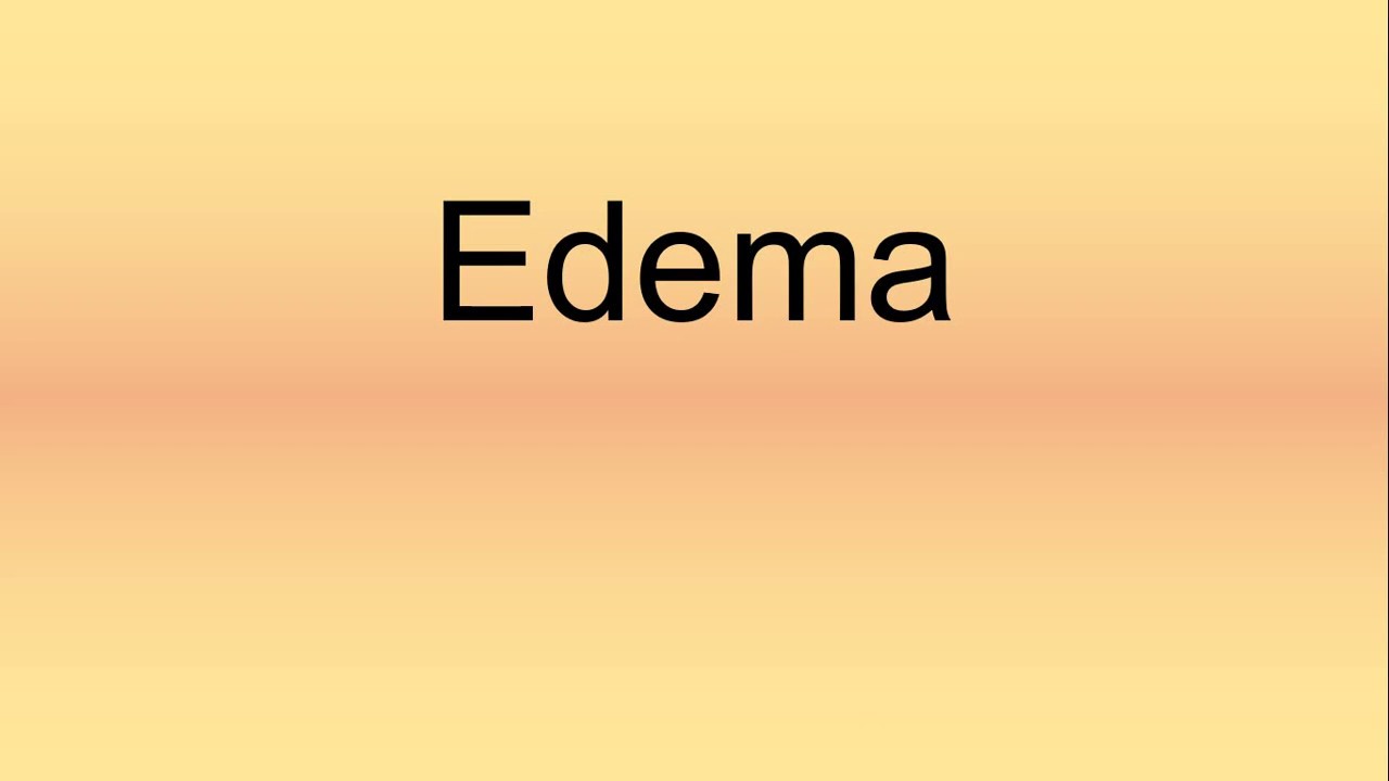 Edema Pronunciation | How to Say | How to Pronounce - YouTube