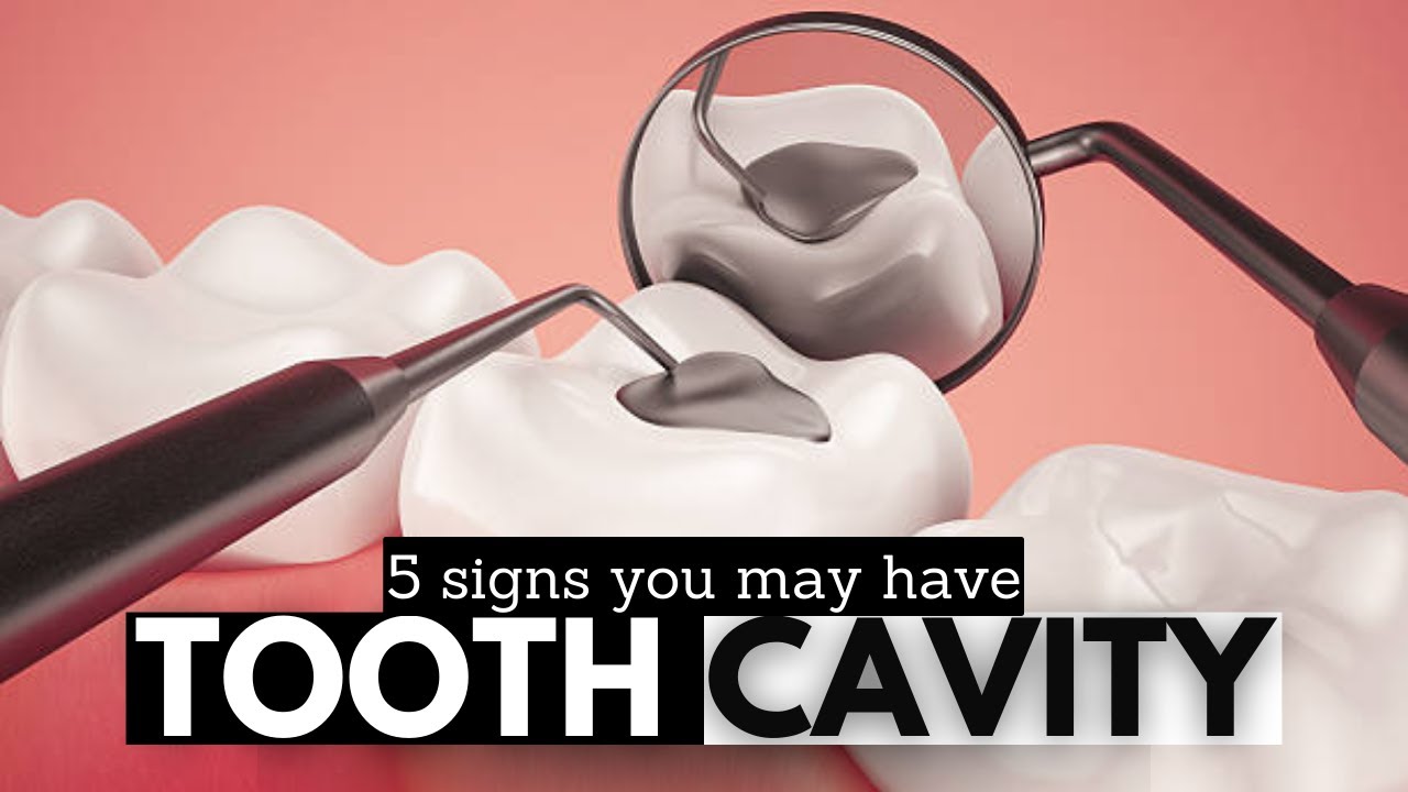 Cavity Alert: Recognizing the 5 Symptoms You Need to Know - YouTube