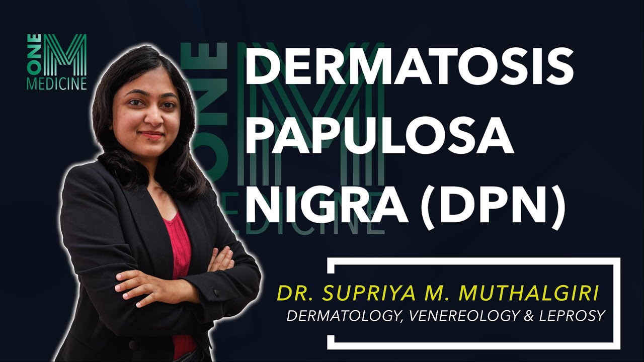 Dermatosis Papulosa Nigra (DPN) | Dermatology | OneMedicine - YouTube