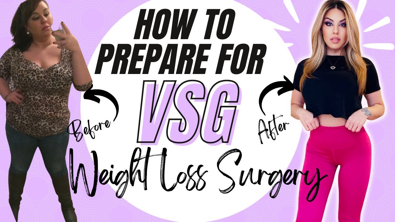 *THE BEST* BEGINNERS GUIDE TO WEIGHT LOSS SURGERY // VSG SURVIVAL TIPS ...