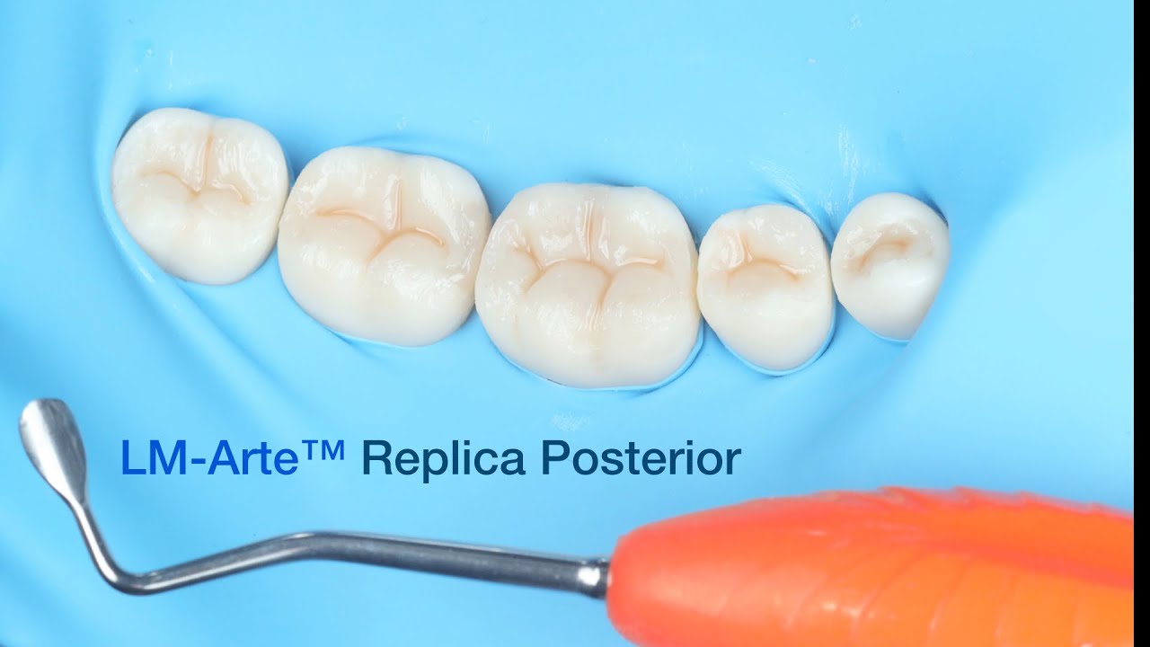 Easy simple way for modeling the occlusal surface of posterior teeth ...