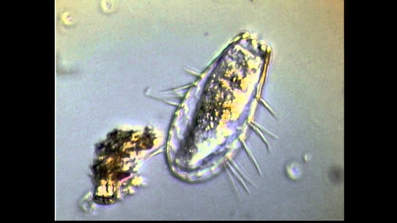 EUGLYPHA TECAMEBA - YouTube