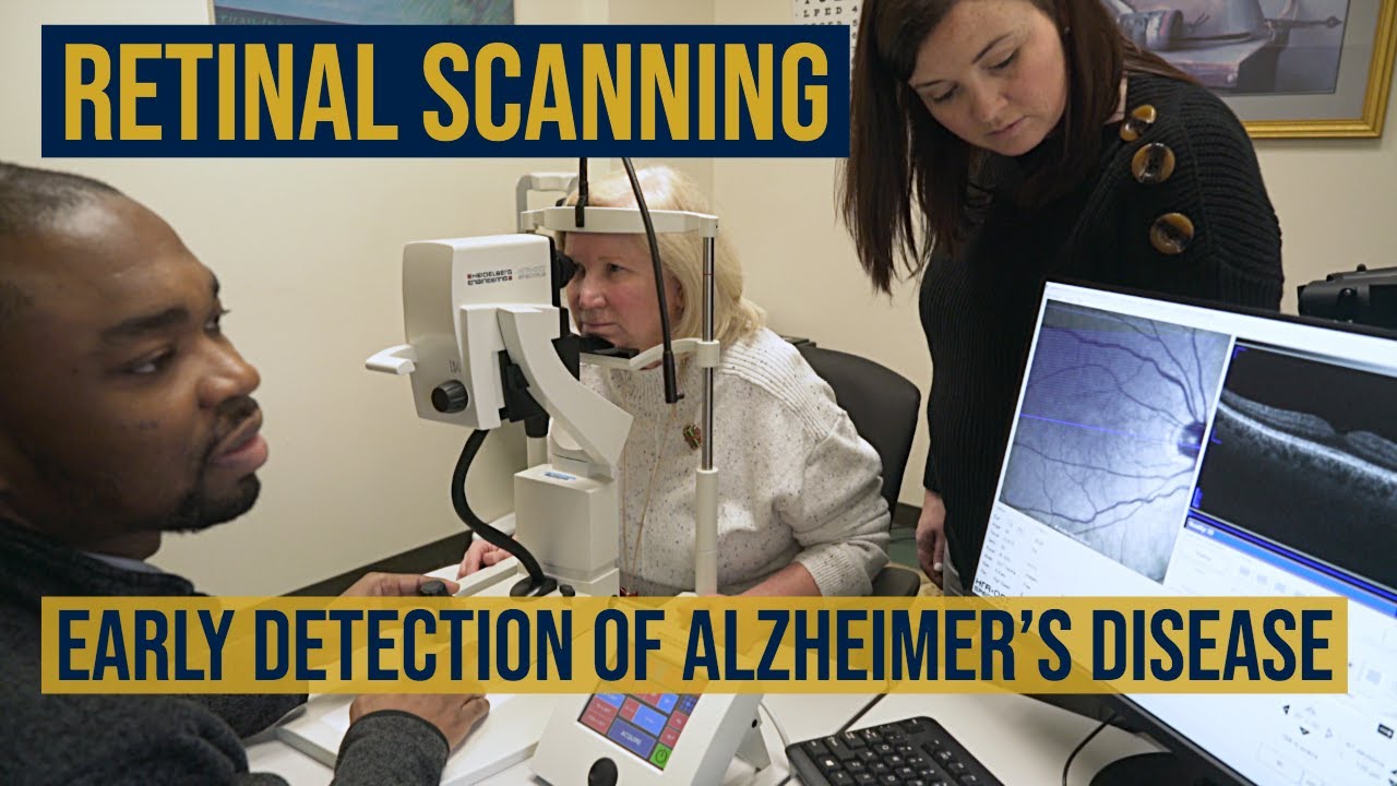 Retinal Scanning | Early Detection of Alzheimer's Disease - YouTube