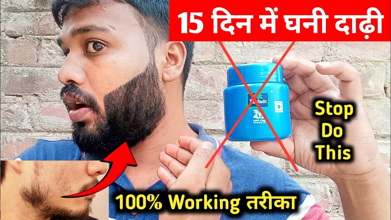 Patchy Beard Growth In 15 Days || Patchy Beard Solution || Dadhi Ghana ...