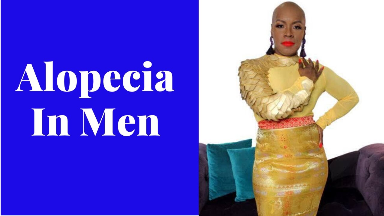 Alopecia Stories - Interview With Jamie Elmore Alopecia Confidence ...