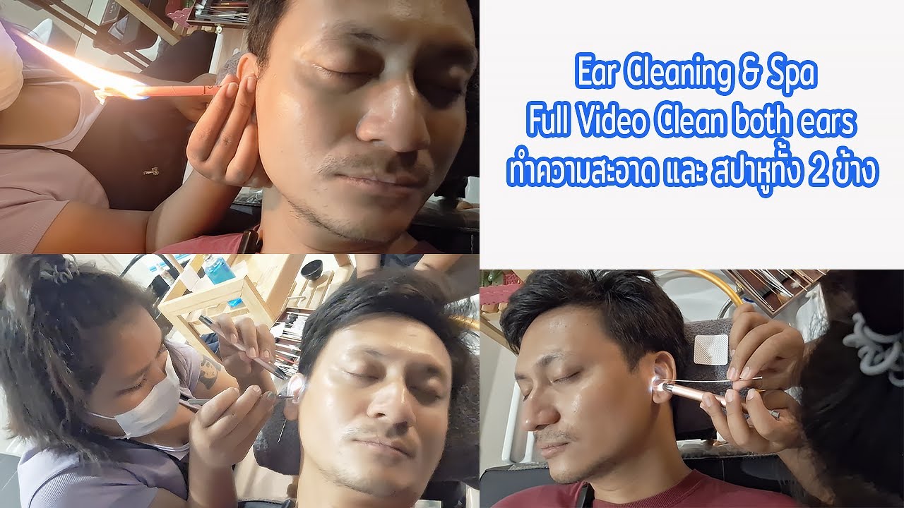 Ear Cleaning & Spa Full Video Clean both ears ทำความสะอาดหูทั้ง 2 ข้าง ...
