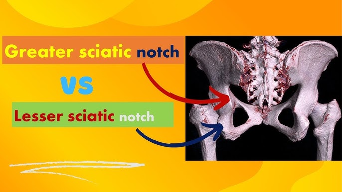 Greater Sciatic Notch