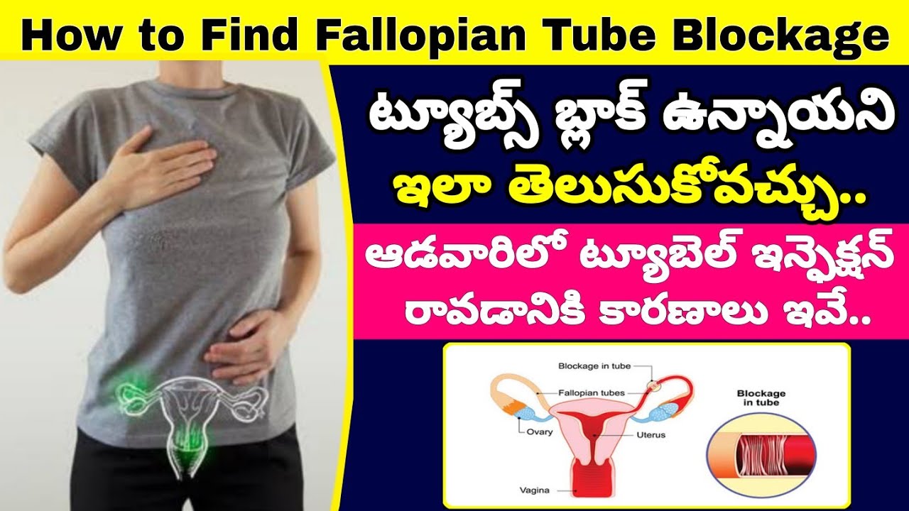 ఆడవాళ్ళలో Fallopian Tubes ఎందుకు Block అవుతాయి? | How to Find If ...