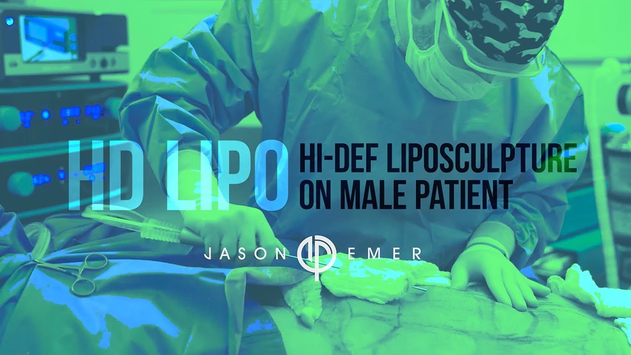 Hi Def HD Liposculpture for Men | Six Pack Body Contouring | Dr. Jason ...