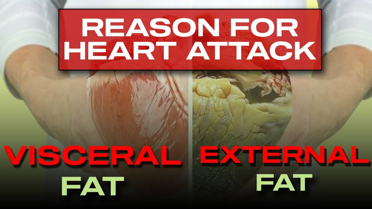 Real Reason Behind Heart Attack For Teenagers And Adults | Internal Fat ...