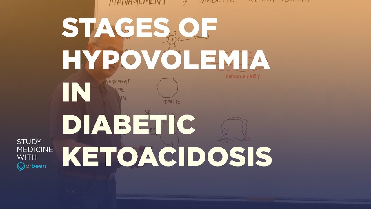 Stages of Hypovolemia in Diabetic Ketoacidosis - Diabetes