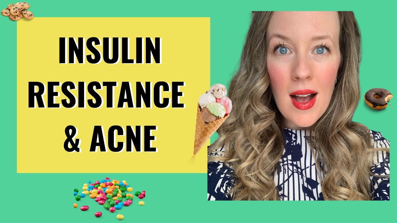 Insulin Resistance and Acne - SWEET TOOTH MAKING YOU BREAKOUT? - YouTube