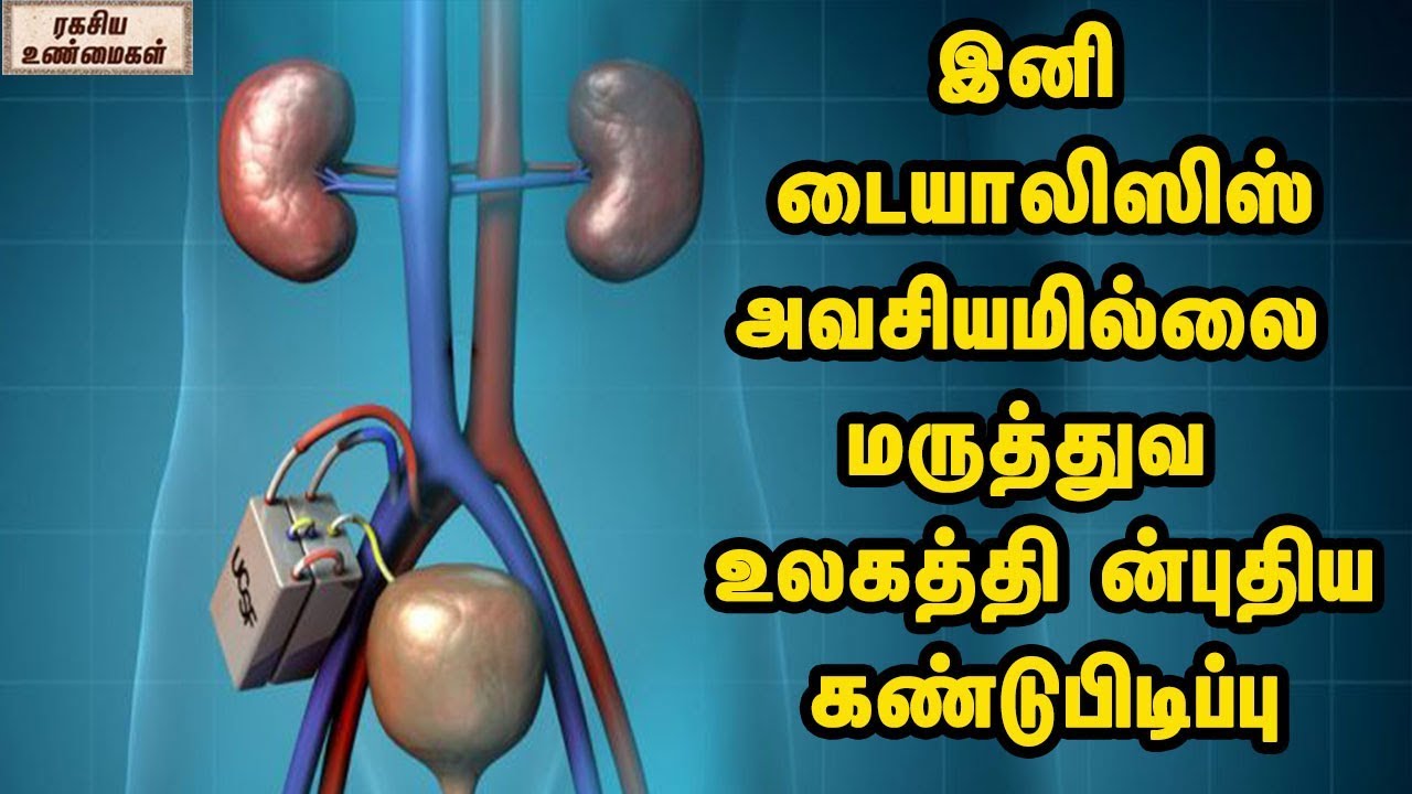 இனி டையாலிஸிஸ் அவசியமில்லை மருத்துவ உலகத்தின் புதிய கண்டுபிடிப்பு ...