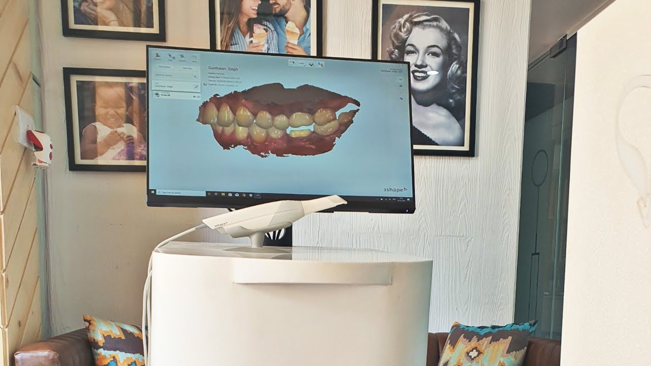 CART OR TROLLEY DESIGN FOR INTRAORAL SCANNER - YouTube